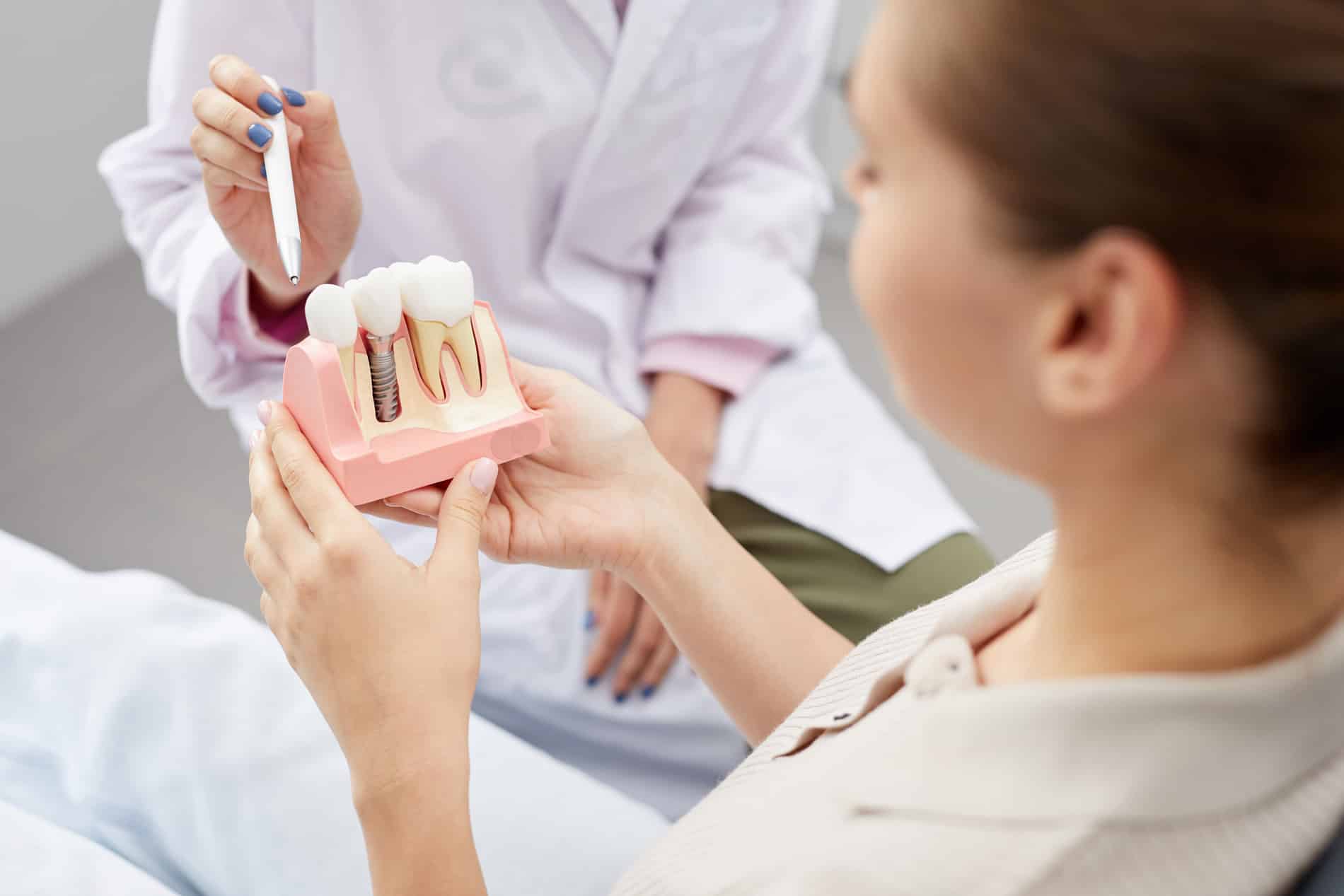 Benefits and Longevity of All-on-X Dental Implant in Rincon GA